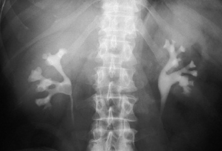 Week van de urologie (17 tot 21 september 2012 ): het jaar van de ...