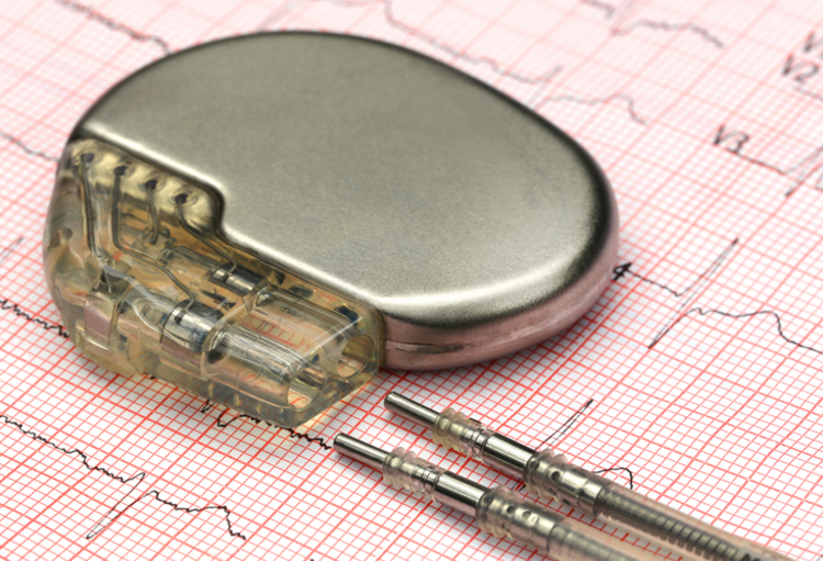 Hacking : des milliers de patients porteurs de pacemakers invités à se rendre à l'hôpital - Le ...
