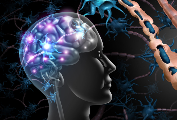 Sclérose en plaques: l'inflammation cause la perte neuronale (étude ...