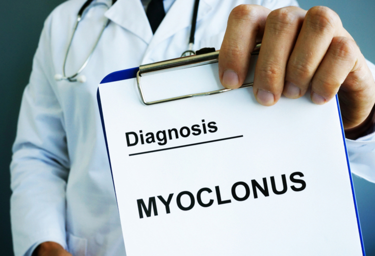 Myoclonus généralisé associé au Covid-19 - Medi-Sphere